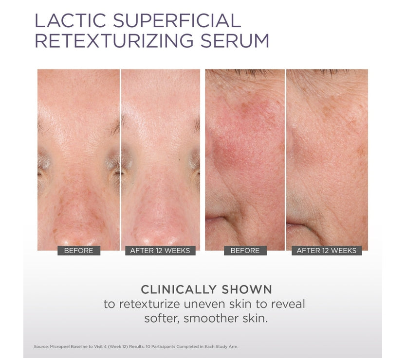 Lactic Superficial Retexturizing Serum – Glytone