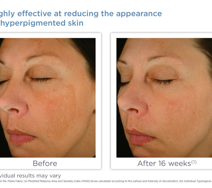 Enhance Brightening Complex – Glytone